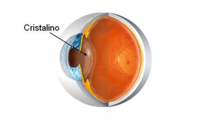 Cristalino - ABCCR/BRASCRS